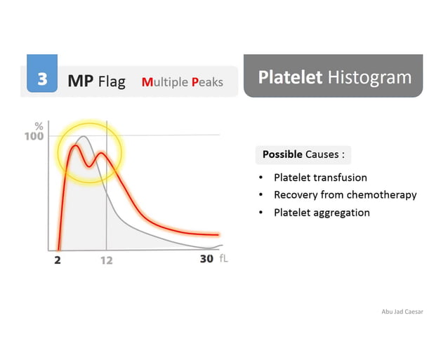 Platelets Histogram