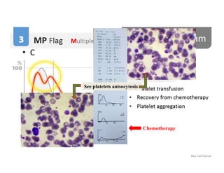 Platelets Histogram | PPT