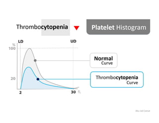 Updated - Platelet histogram | PPT