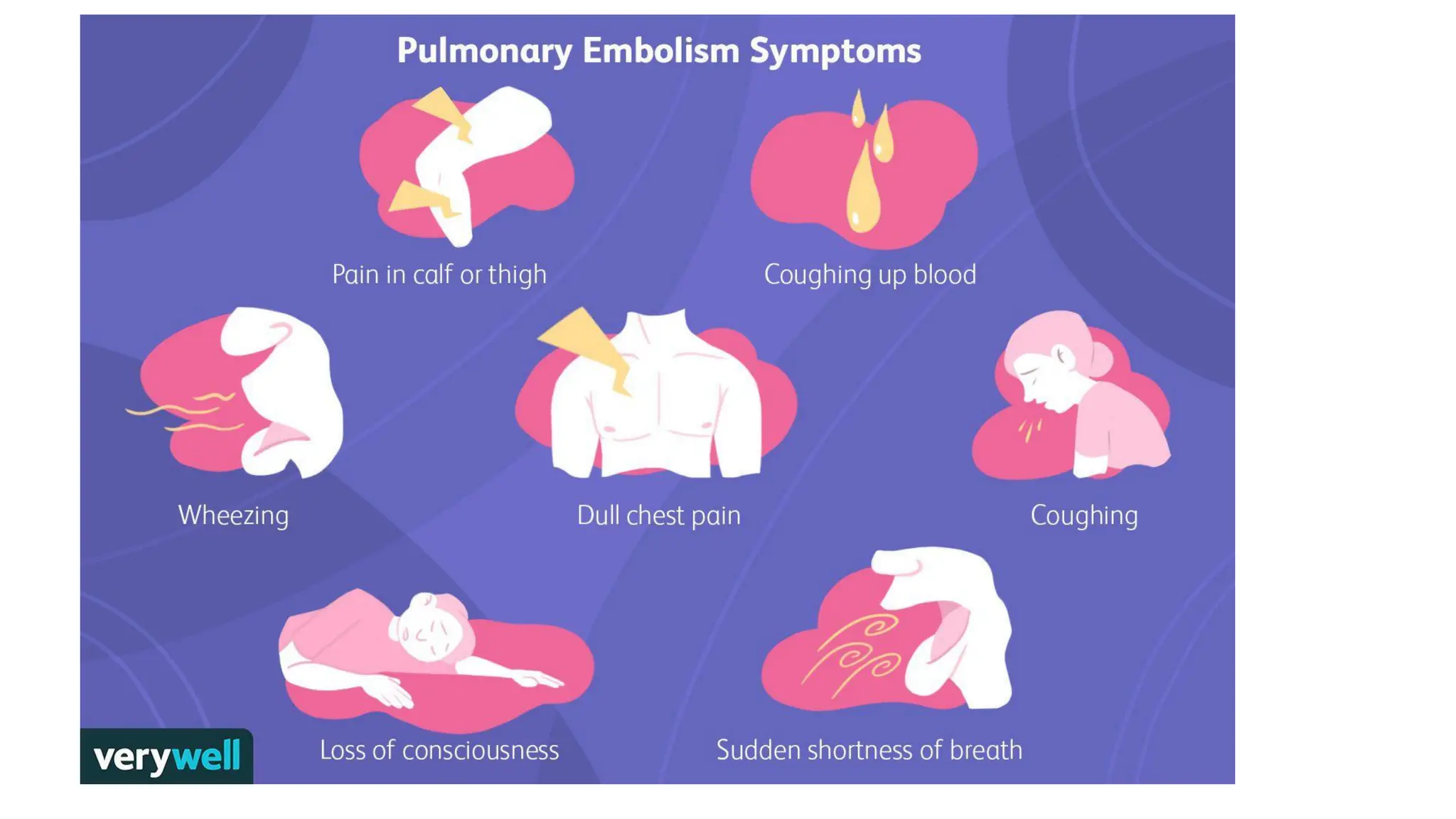 Plumunary Infarction. death of part of the lungs | PPT