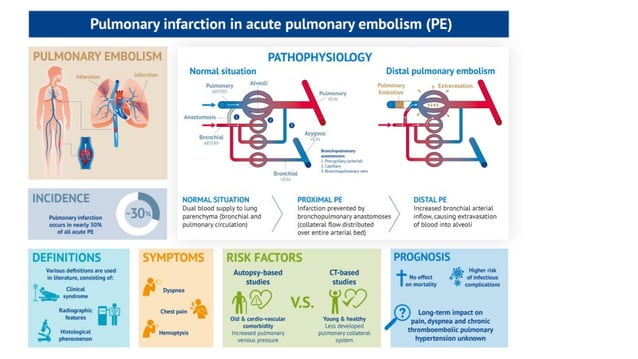 Plumunary Infarction.pptx DEATH OF PART OF LUNG | PPTX | Lung and ...