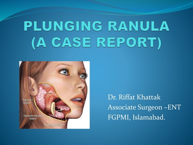 PLUNGING RANULA- A CASE REPORT.(Deep, diving or a cervical ranula) | PPTX | Ear, Nose and Throat ...