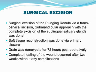 PLUNGING RANULA- A CASE REPORT.(Deep, diving or a cervical ranula) | PPTX