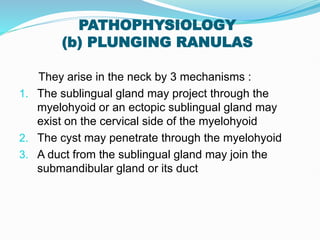 PLUNGING RANULA- A CASE REPORT.(Deep, diving or a cervical ranula) | PPTX