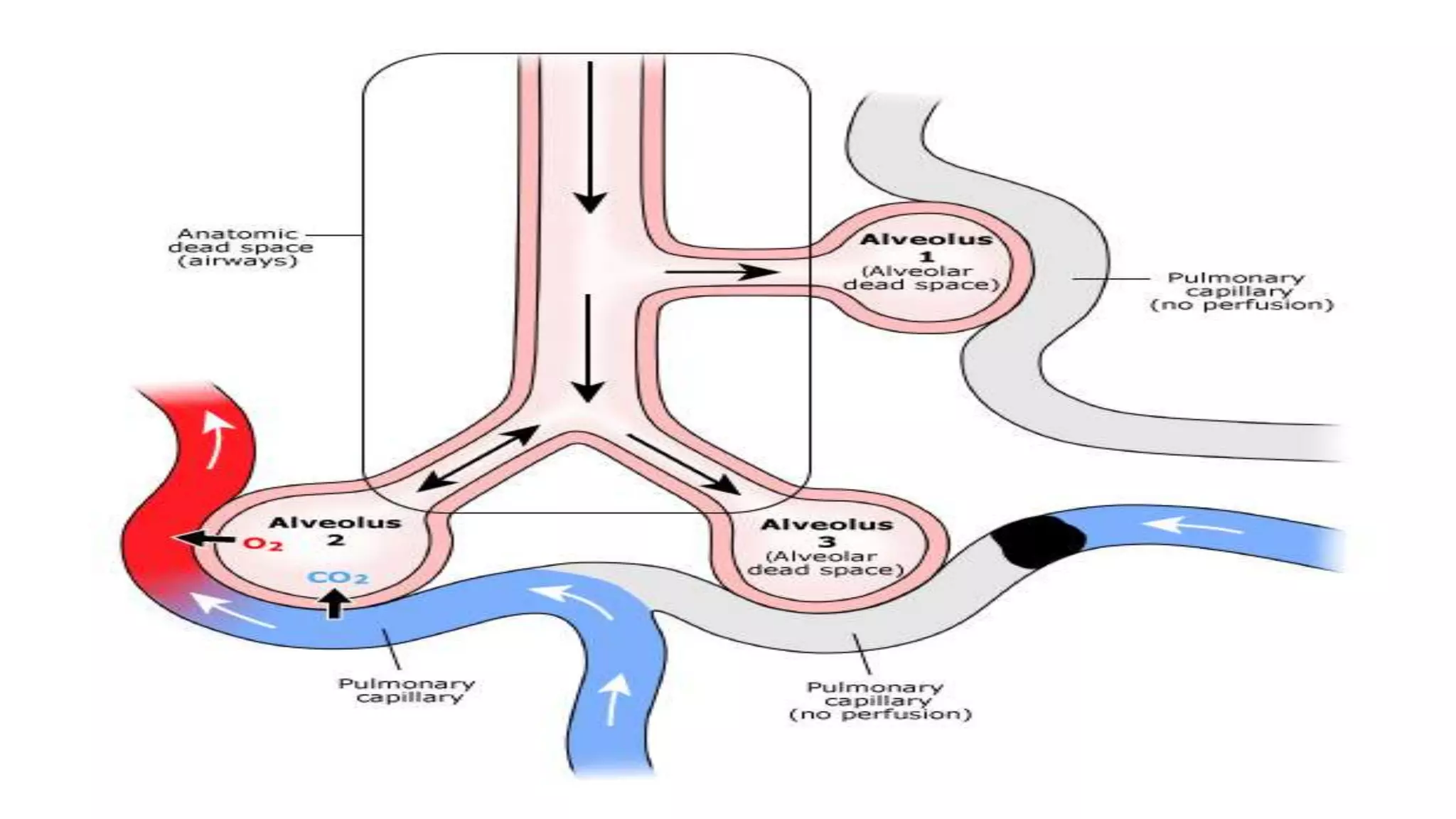 Plural effusion, PE & lung abscess, pneumothorax_014402.pptx