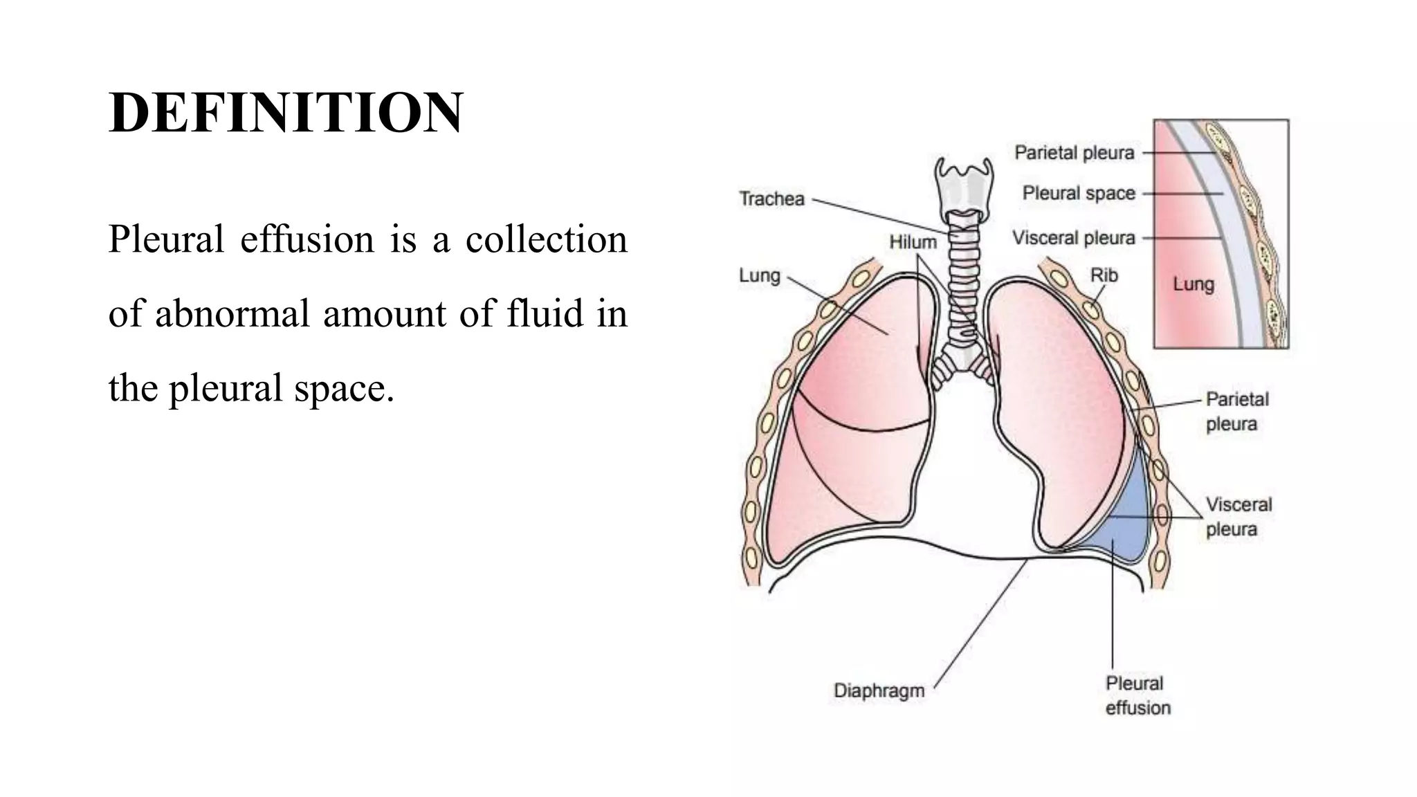 Plural effusion, PE & lung abscess, pneumothorax_014402.pptx