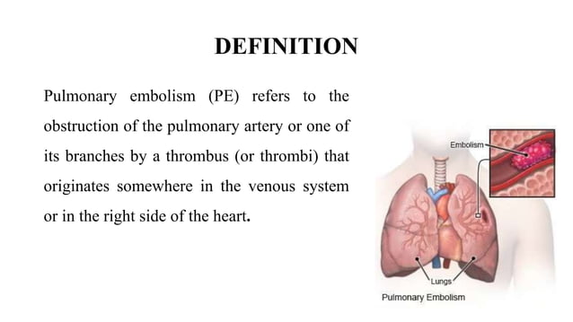 Plural effusion, PE & lung abscess, pneumothorax_014402.pptx