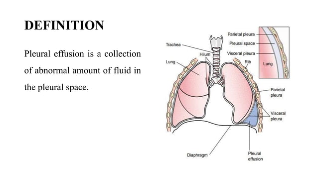 Plural effusion, PE & lung abscess, pneumothorax_014402.pptx