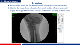 PLX112B Operation Instructions.pptx