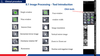 PLX112B Operation Instructions.pptx