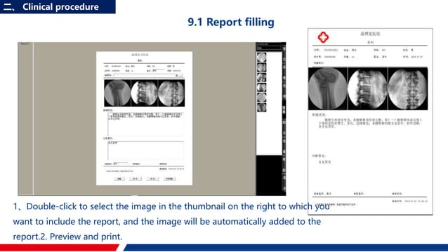PLX112B Operation Instructions.pptx