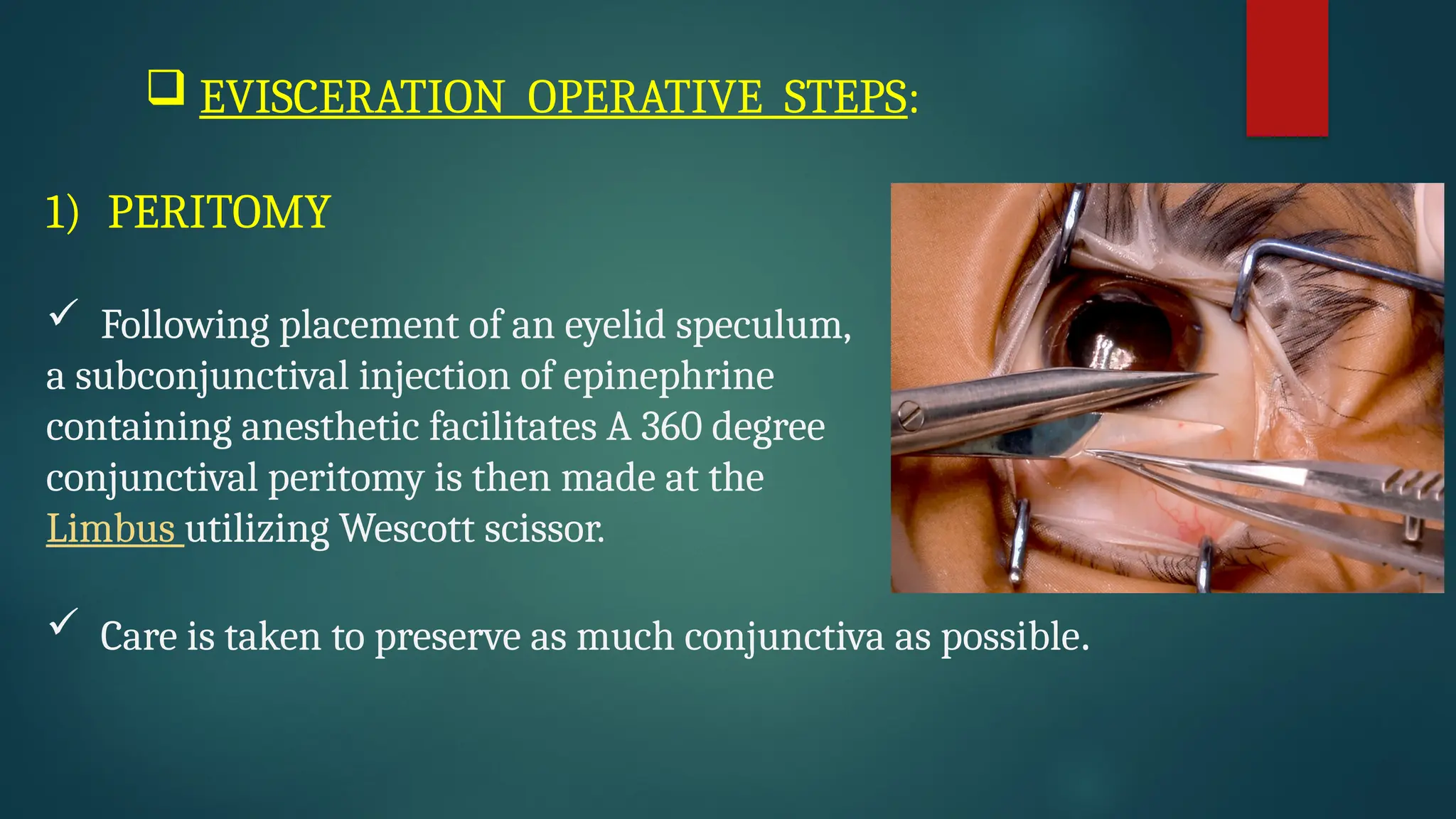 ENUCLEATION_and_EVISCERATION.pptx BY Dr Ravindrakumar | PPTX