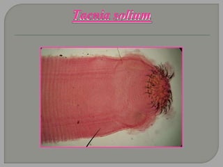 teniasis-cisticercosis | PPTX