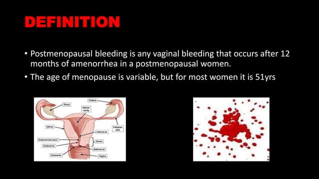 Post menopausal bleeding | PPTX | Menopause | Endocrine and Metabolic ...