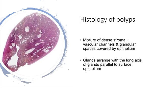 Pmb causes - mx lecture part 2 | PPT