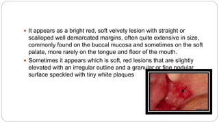 POTENTIALLY MALIGNANT DISORDER | PPTX