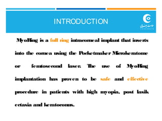 MyoRing in pellucid marginal degeneration | PPT