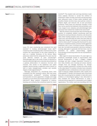 'Multi Procedural Approach to Facial Rejuvenation' | PDF