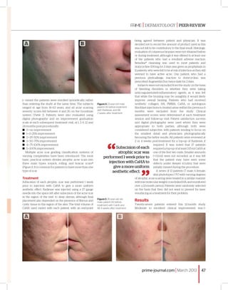 Radiesse study on atrophic acne scarring | PDF