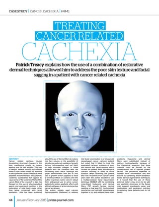 Treating face wasting secondary to cancer related cachexia | PDF
