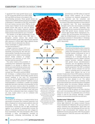 Treating face wasting secondary to cancer related cachexia | PDF