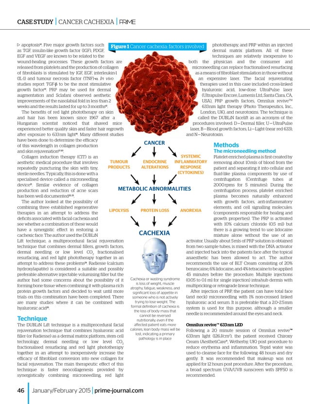 Treating face wasting secondary to cancer related cachexia | PDF