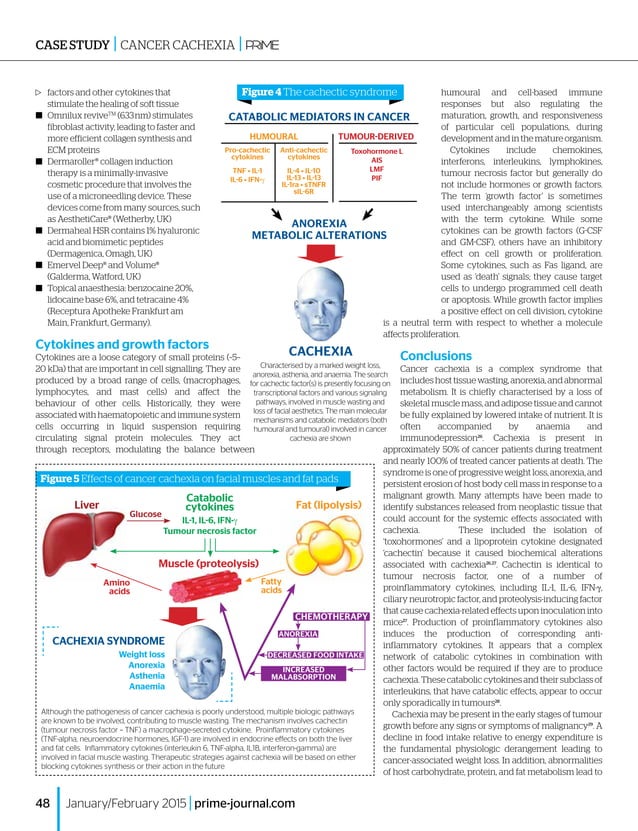 Treating face wasting secondary to cancer related cachexia | PDF