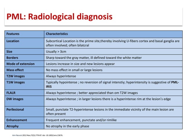 Progressive multifocal leukoencephalopathy (PML) | PDF