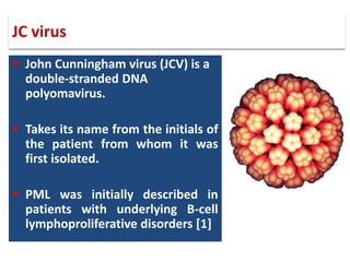 Progressive Multifocal Leukoencephalopathy