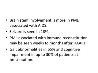 Progressive Multifocal Leucoencephalopathy | PPTX