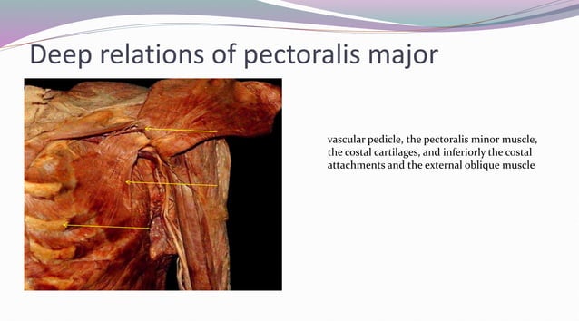 PMMC FLAP | PPT