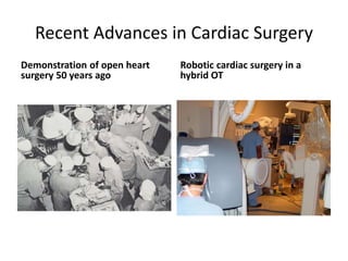 Recent Advances in Cardiothoracic Surgery | PPTX