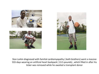 Recent Advances in Cardiothoracic Surgery | PPTX