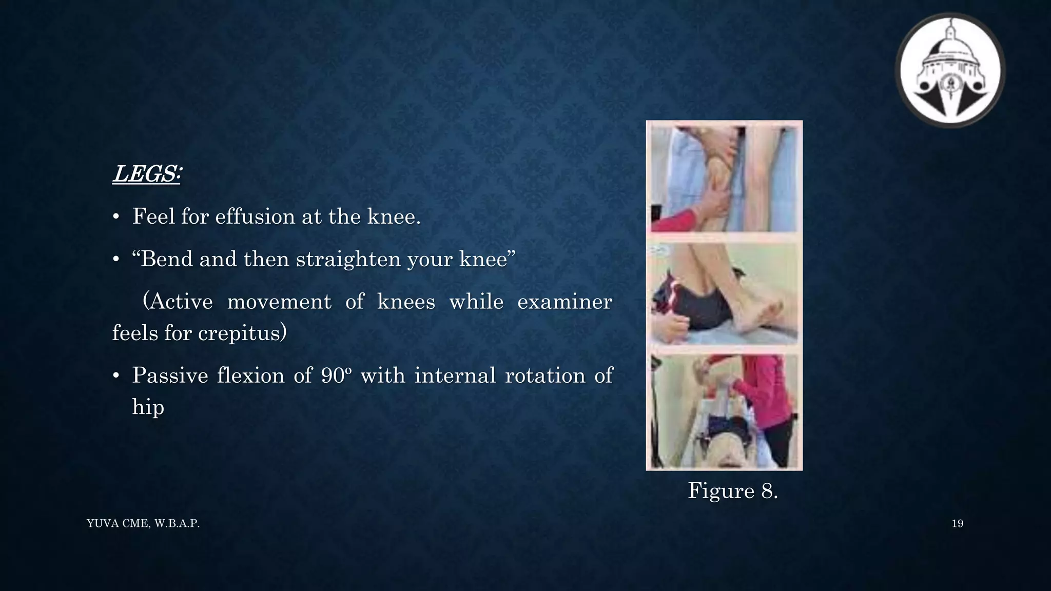 Pediatric musculoskeletal examination including P-GALS | PPTX