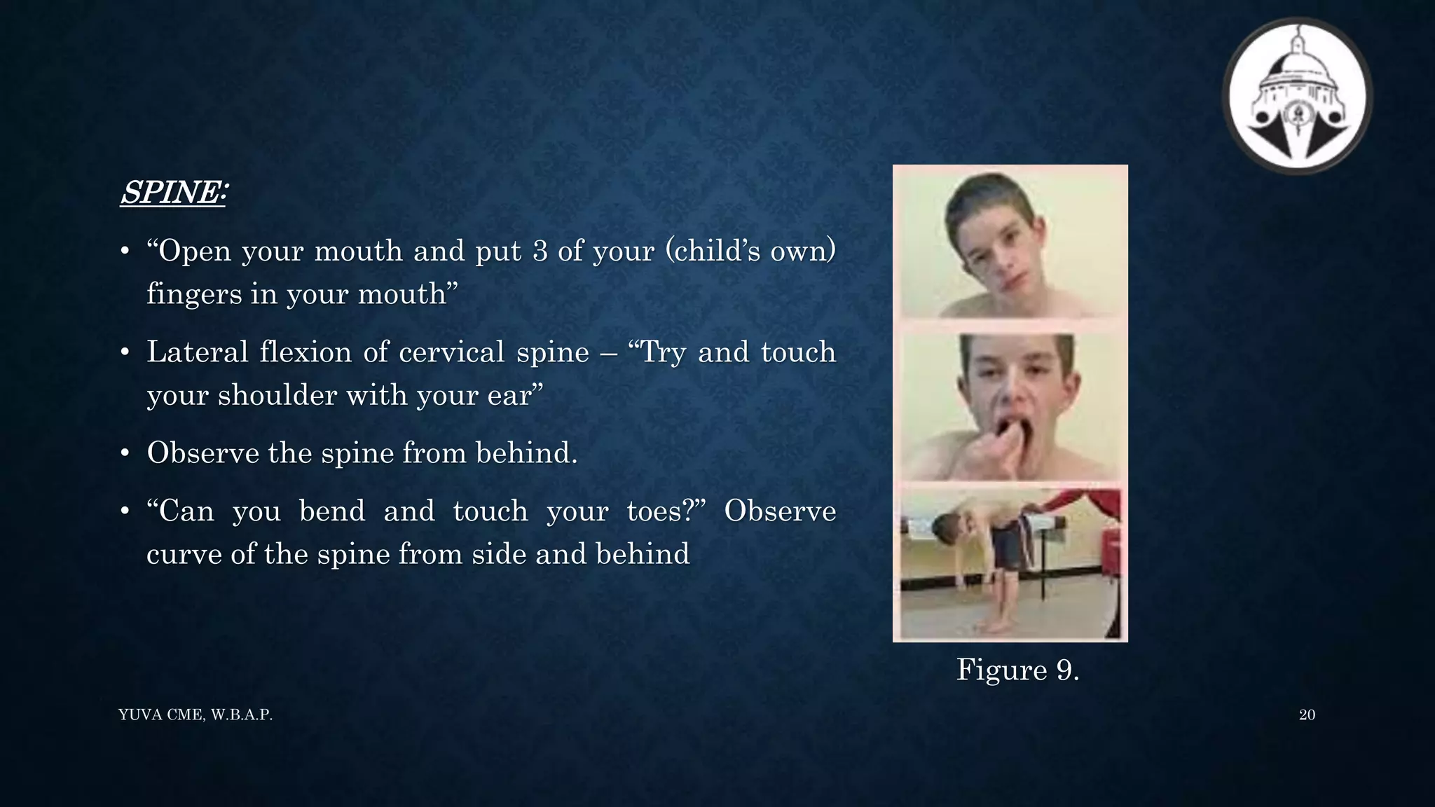 Pediatric musculoskeletal examination including P-GALS | PPTX