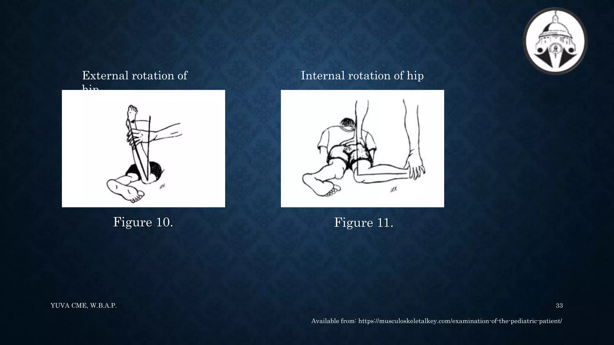 Pediatric musculoskeletal examination including P-GALS | PPTX