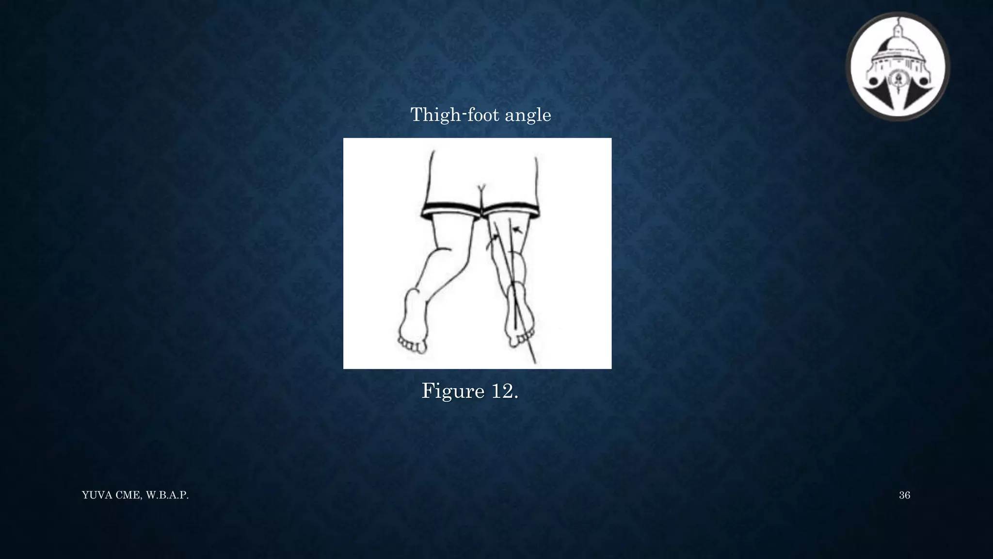 Pediatric musculoskeletal examination including P-GALS | PPTX