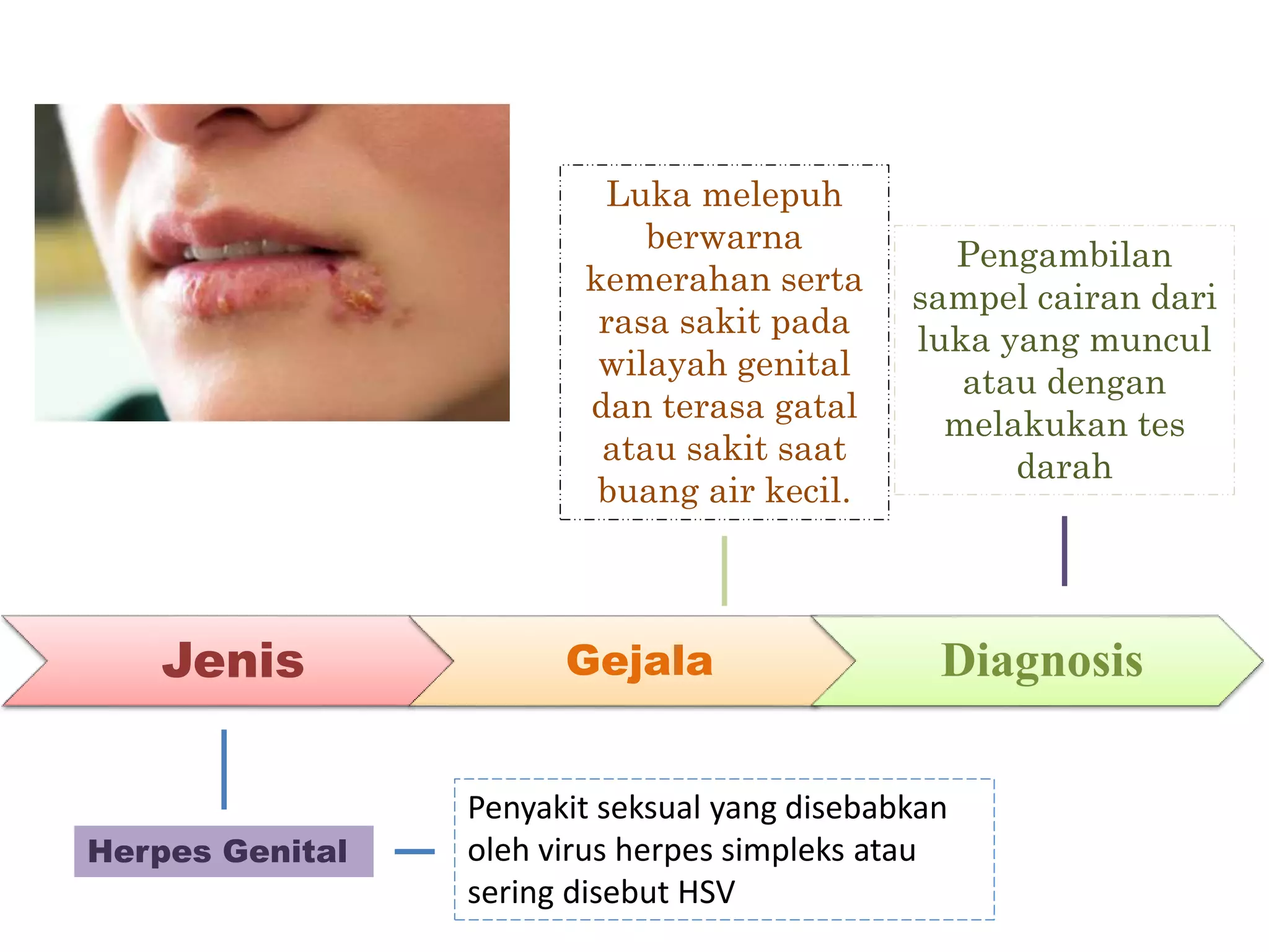 PPT Penyakit Menular Seksual | PPTX
