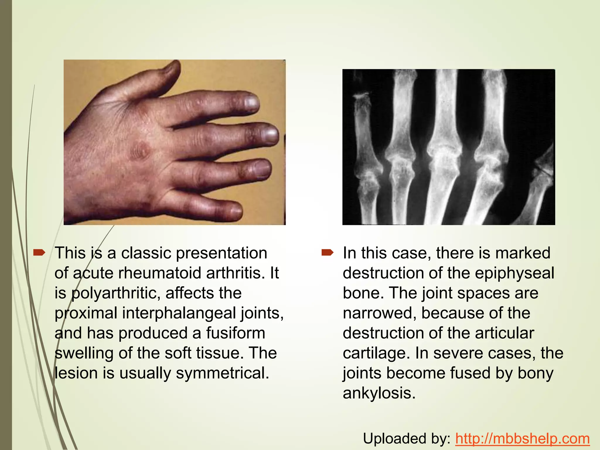 PATHOLOGY OF THE MUSCULOSKELETAL SYSTEM | PPTX