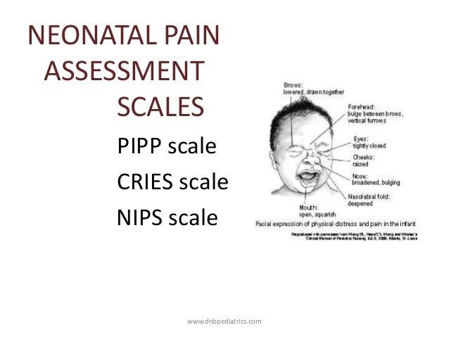 Neonatal Pain Assessment Scale Pipp