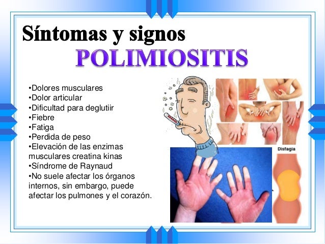 Polimiositis y dermatomiositis