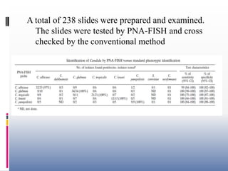 Pna fish by dr prabhash | PPT