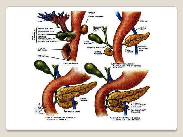 Radiografia Anular Do Pancreas
