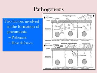 CASE PRESENTATION ON PNEUMONIA | PPTX