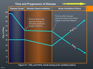 DIAGNOSIS OF PNEUMONIA Dr Vinay Verma | PPT