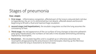 Pneumococcal pneumonia in adults overview.pptx