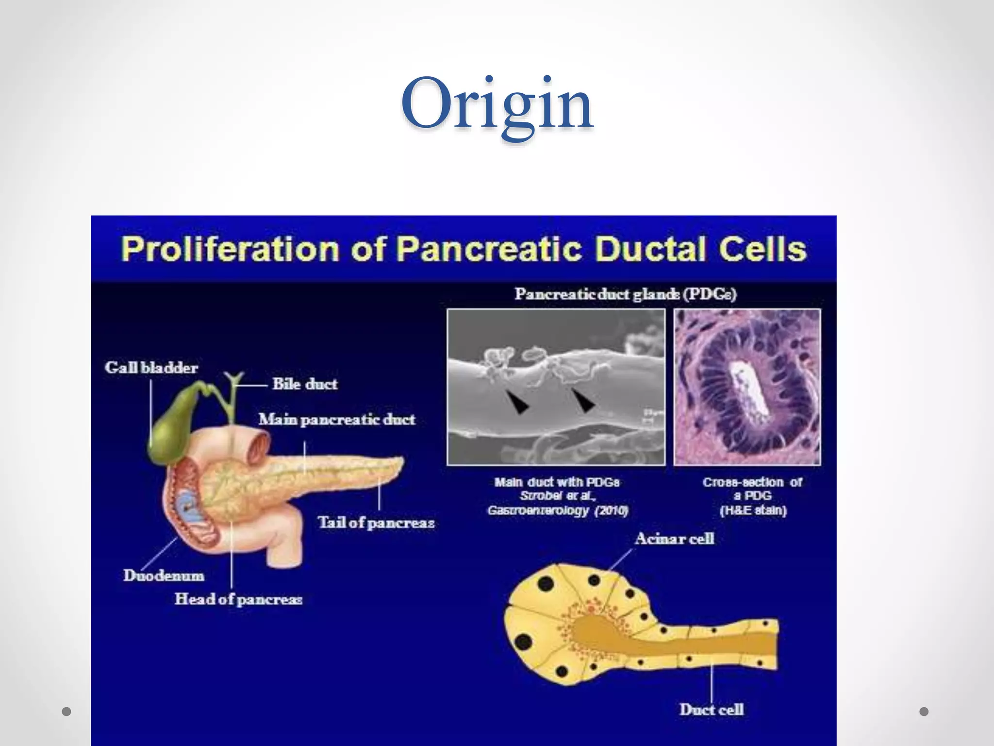 Pancreatic neuroendocrine tumors | PPTX
