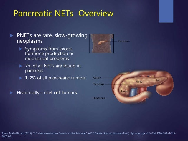Functional Pancreatic Neuroendocrine Tumors Youtube