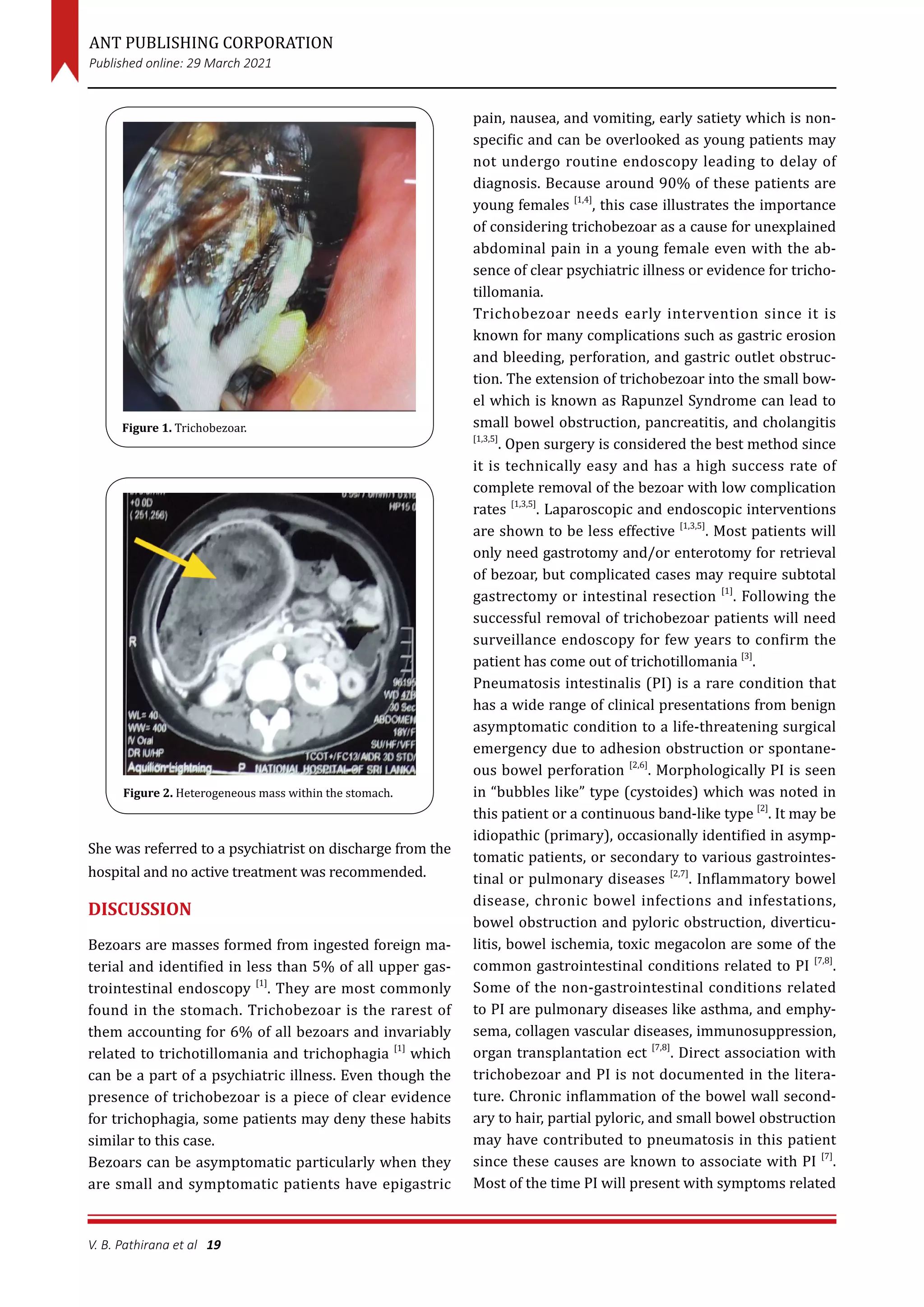 Pneumatosis intestinalis in a patient with trichobezoar – rare ...