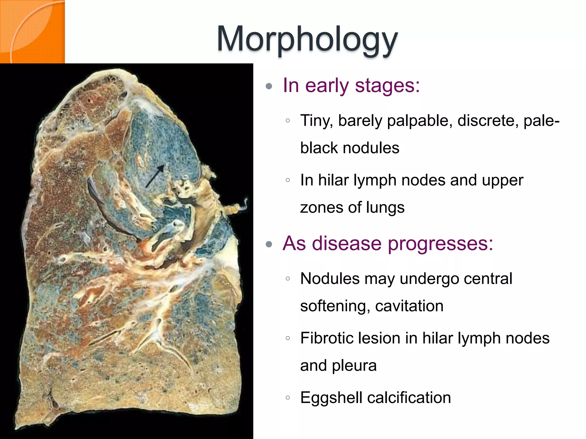 pathology of environmental diseases | PPTX